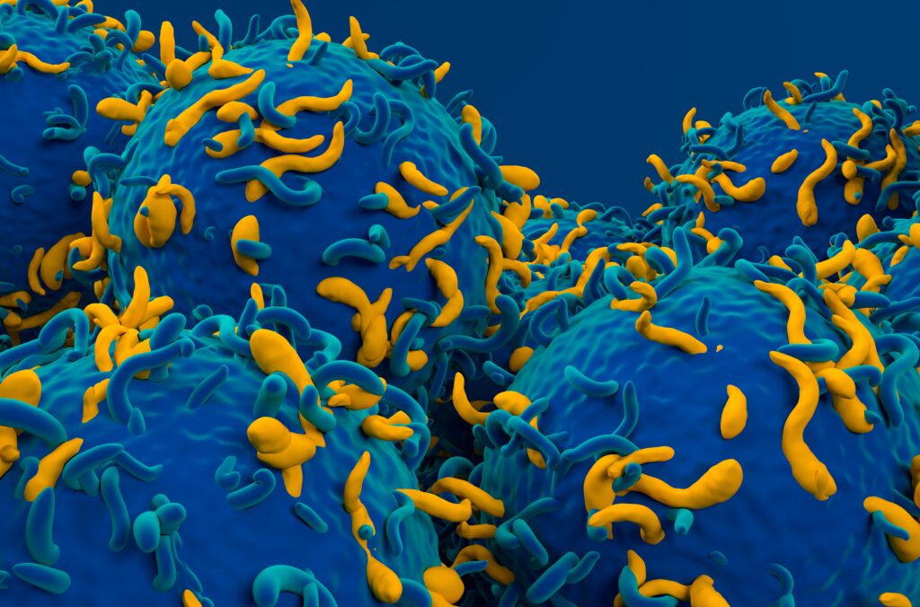 大B细胞淋巴瘤治疗新突破：新型CD19 CAR T细胞疗法临床研究显示显著疗效与安全性 - MedFind