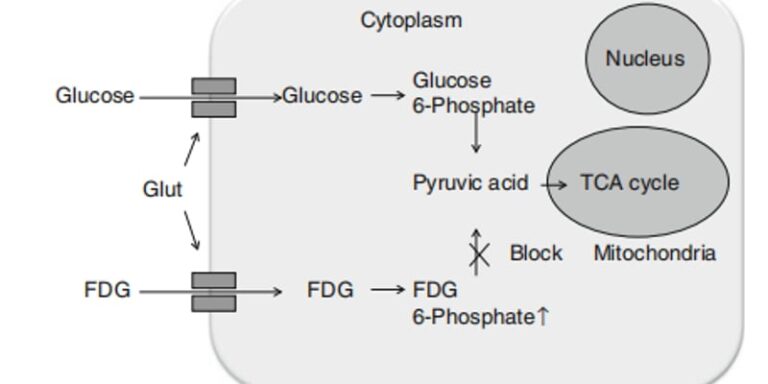 胰腺癌新突破！KRAS G12D抑制剂GFH375临床研究：疾病控制率高达96.7% - MedFind